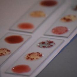 Blood Testing Camp - University of Central Punjab